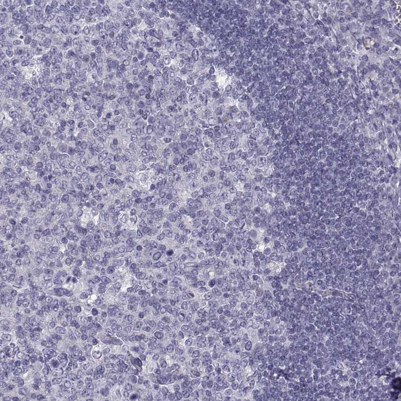 Rabbit Polyclonal Anti-CALCR Antibody - Buy for research - Highly ...