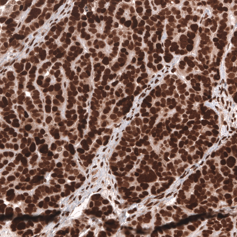 Anti-BCOR Monoclonal Atlas Antibody