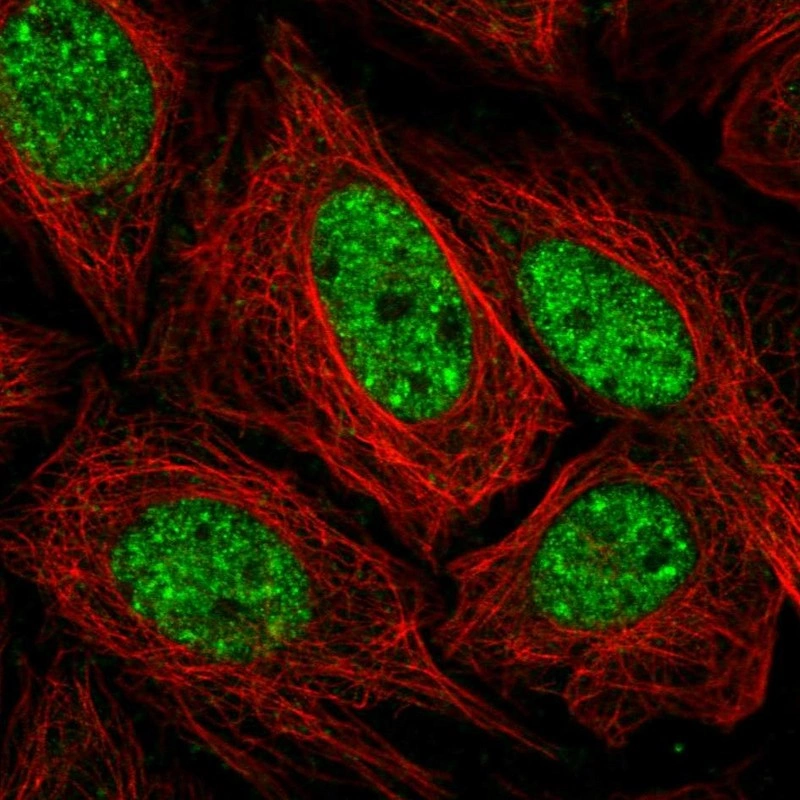 Anti-ATP2A2 Human Protein Atlas Antibody