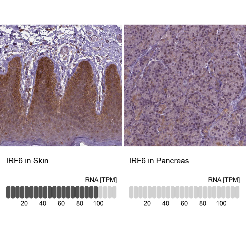 Rabbit Polyclonal Anti-IRF6 Antibody - Buy for research - Highly ...