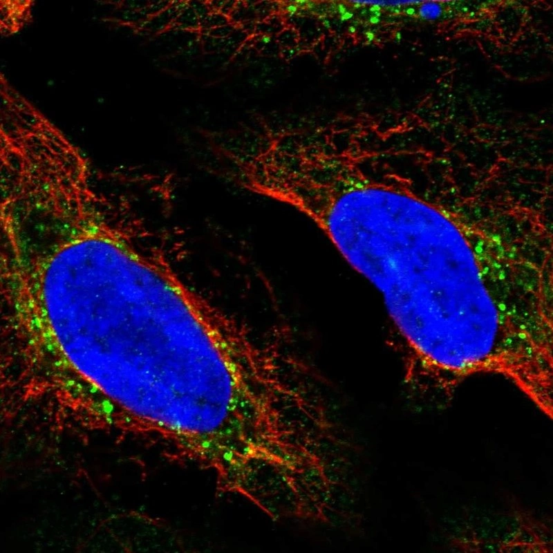 Anti-RDH5 Human Protein Atlas Antibody