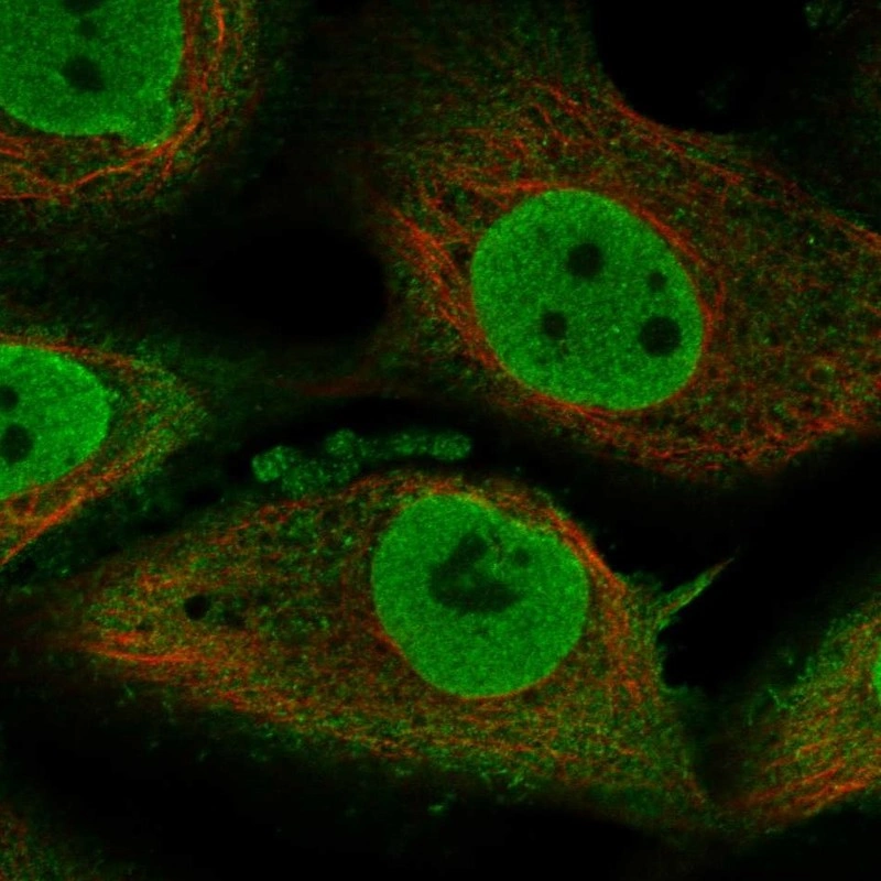 Rabbit Polyclonal Anti-TENM1 Antibody - Buy for research - Highly ...