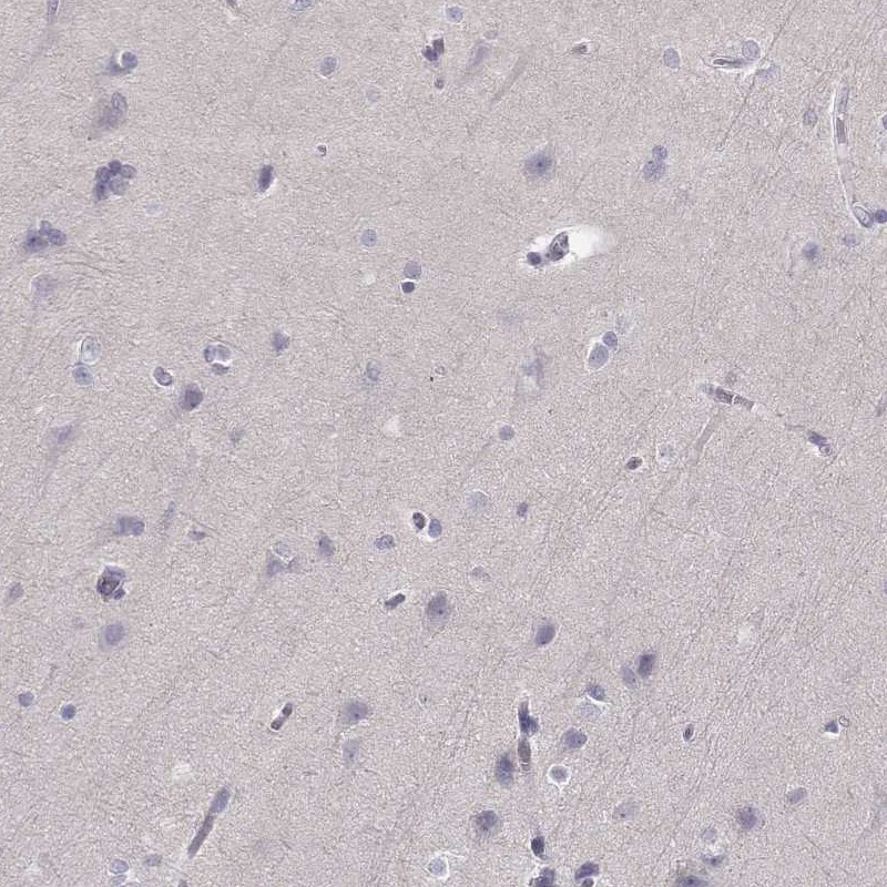 Anti-P2RY10 Human Protein Atlas Antibody