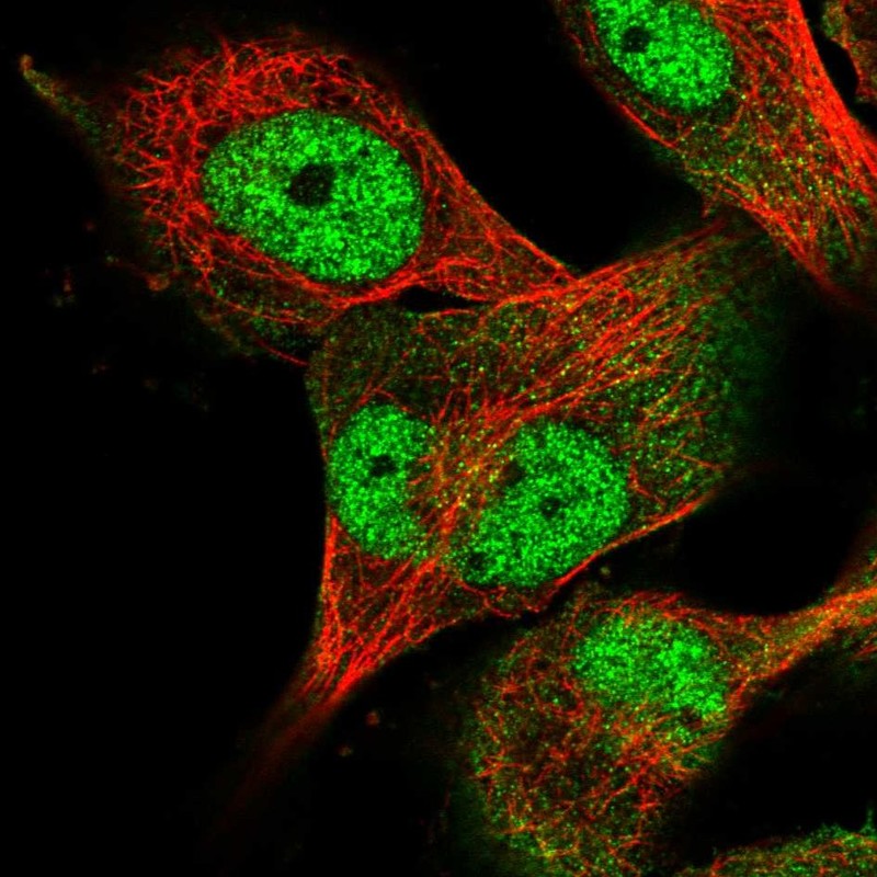 Rabbit Polyclonal Anti-USP24 Antibody - Buy for research - Highly specific, rigorously validated ...