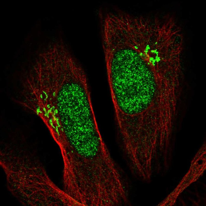 Rabbit Polyclonal Anti-PSMD11 Antibody - Buy for research - Highly ...