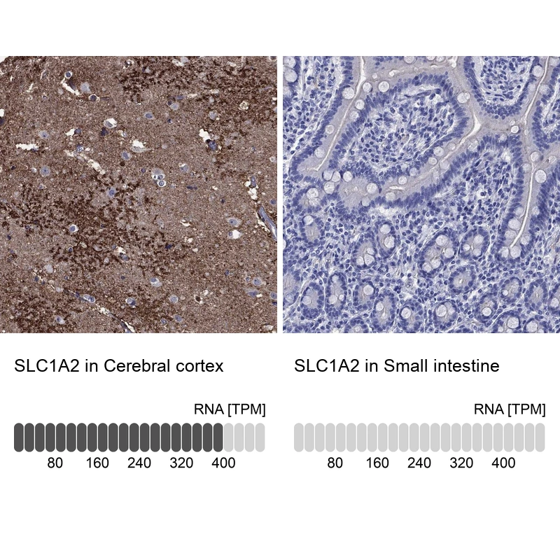 Anti-SLC1A2 Human Protein Atlas Antibody