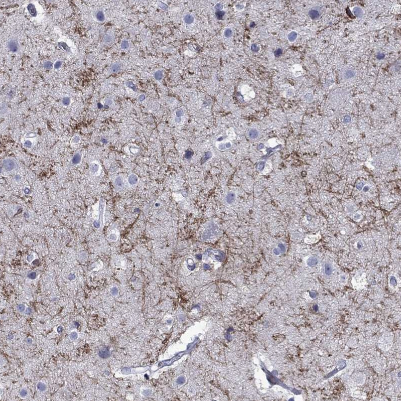 Rabbit Polyclonal Anti-ENPP6 Antibody - Buy for research - Highly ...