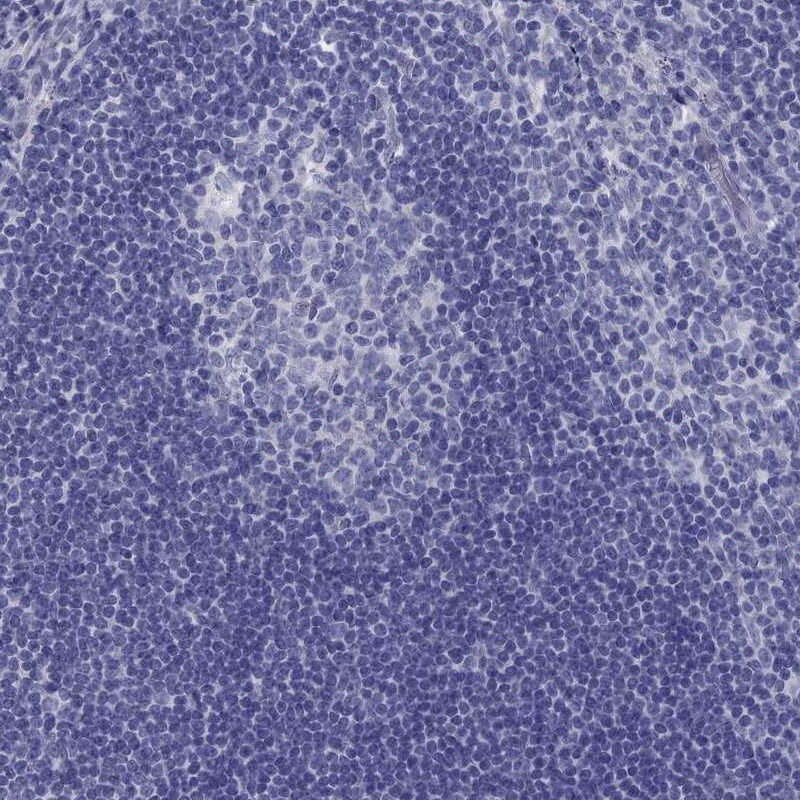 Rabbit Polyclonal Anti-TGM4 Antibody - Buy for research - Highly ...