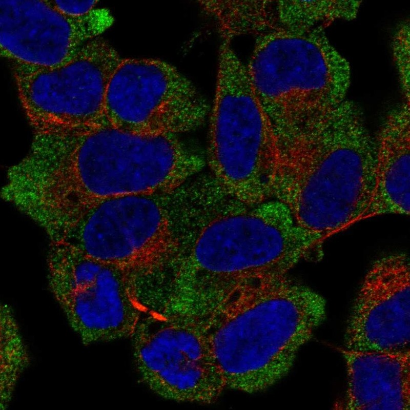 Rabbit Polyclonal Anti-NACA Antibody - Buy for research - Highly specific, rigorously validated ...