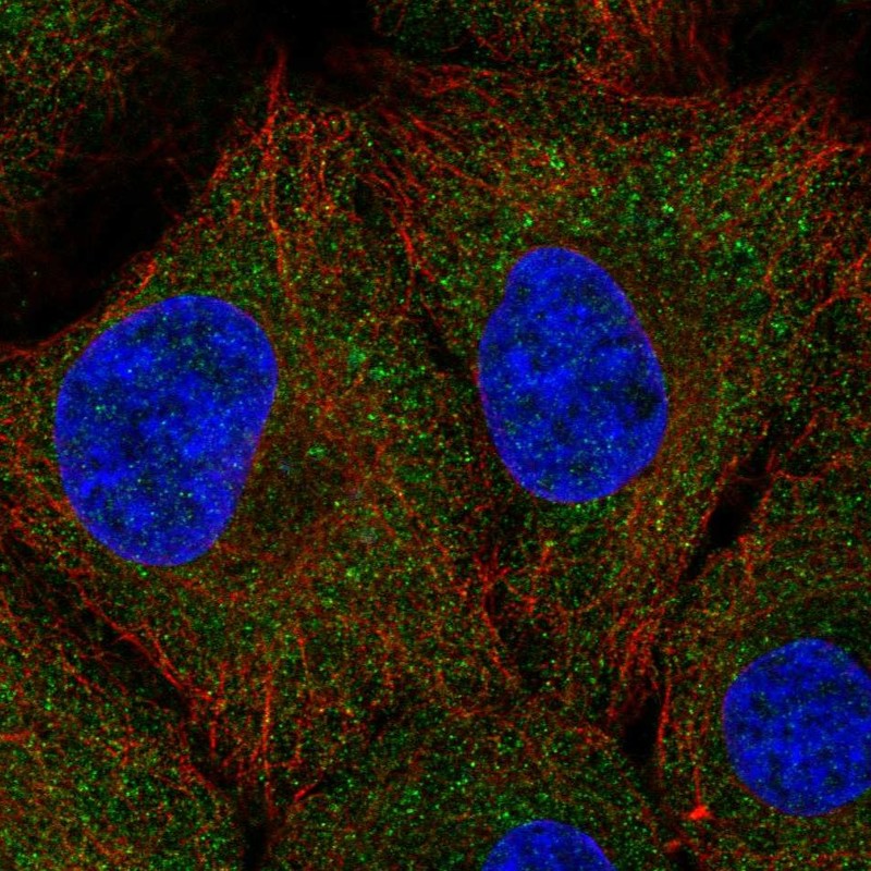 Rabbit Polyclonal Anti-UNKL Antibody - Buy for research - Highly ...