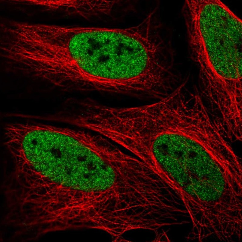 Rabbit Polyclonal Anti-ZMYM3 Antibody - Buy for research - Highly ...