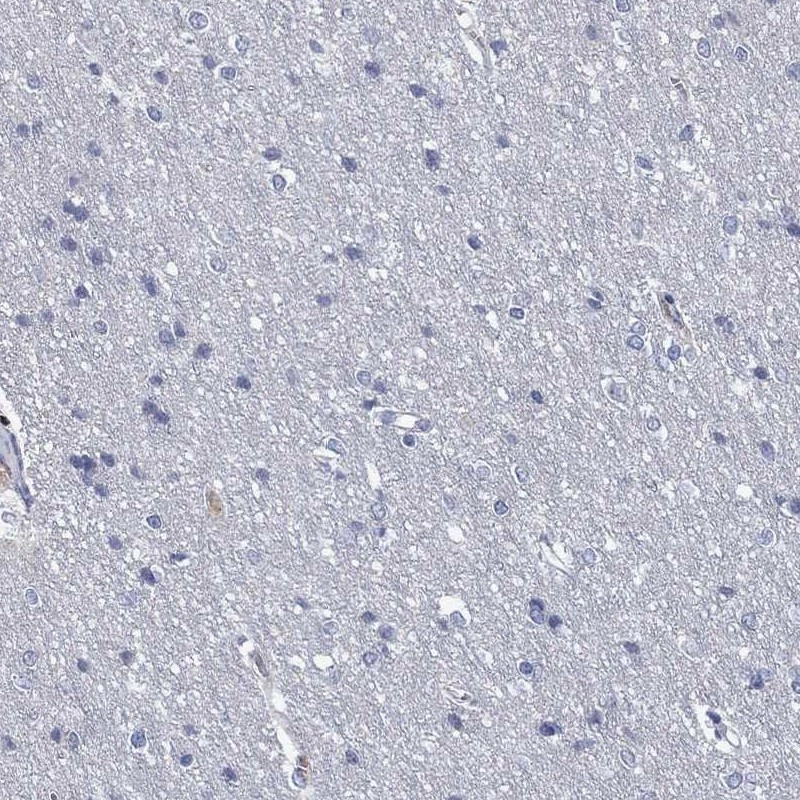 Anti-GZMA Human Protein Atlas Antibody