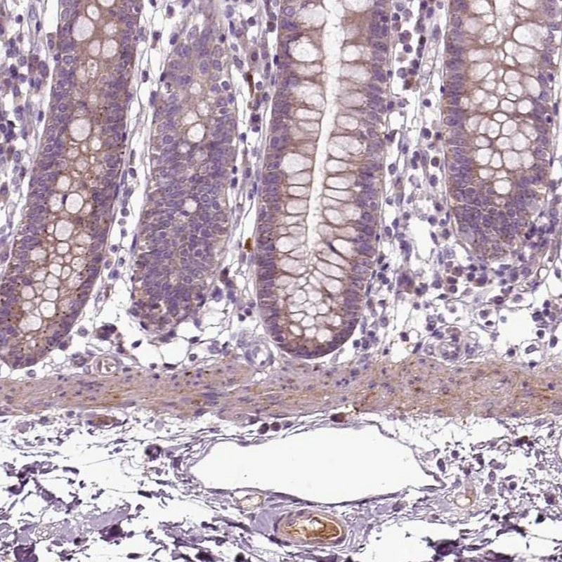 Anti-SPON1 Human Protein Atlas Antibody