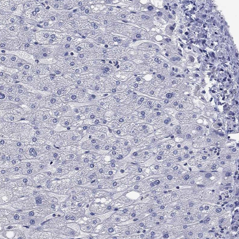 Rabbit Polyclonal Anti-NACAD Antibody - Buy for research - Highly ...