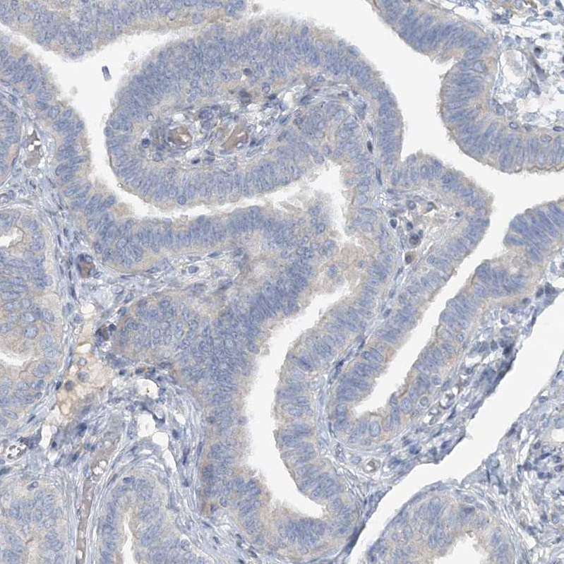 Rabbit Polyclonal Anti-SLC4A10 Antibody - Buy for research - Highly ...