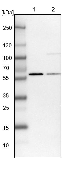 Rabbit Polyclonal Anti-UMPS Antibody - Buy for research - Highly specific, rigorously validated ...