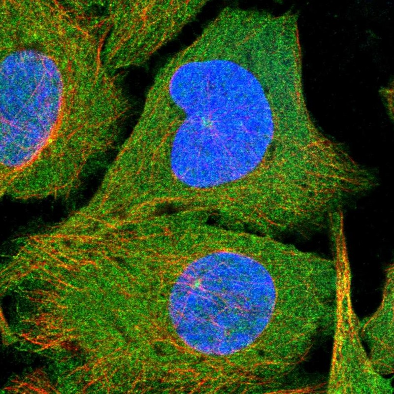 Rabbit Polyclonal Anti-N4BP2 Antibody - Buy for research - Highly ...