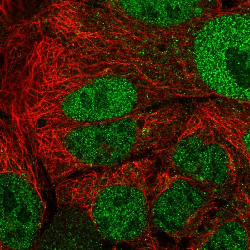 Rabbit Polyclonal Anti-NAXE Antibody - Buy for research - Highly ...