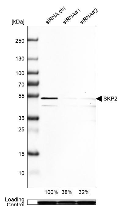 Rabbit Polyclonal Anti-SKP2 Antibody - Buy for research - Highly ...