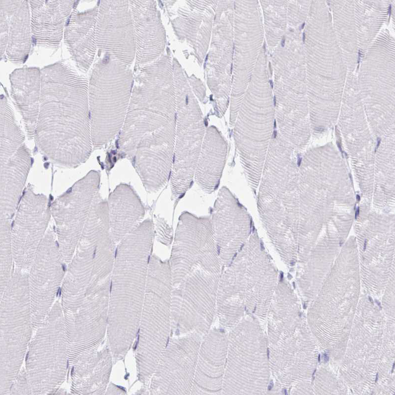 Rabbit Polyclonal Anti-CDH19 Antibody - Buy for research - Highly ...