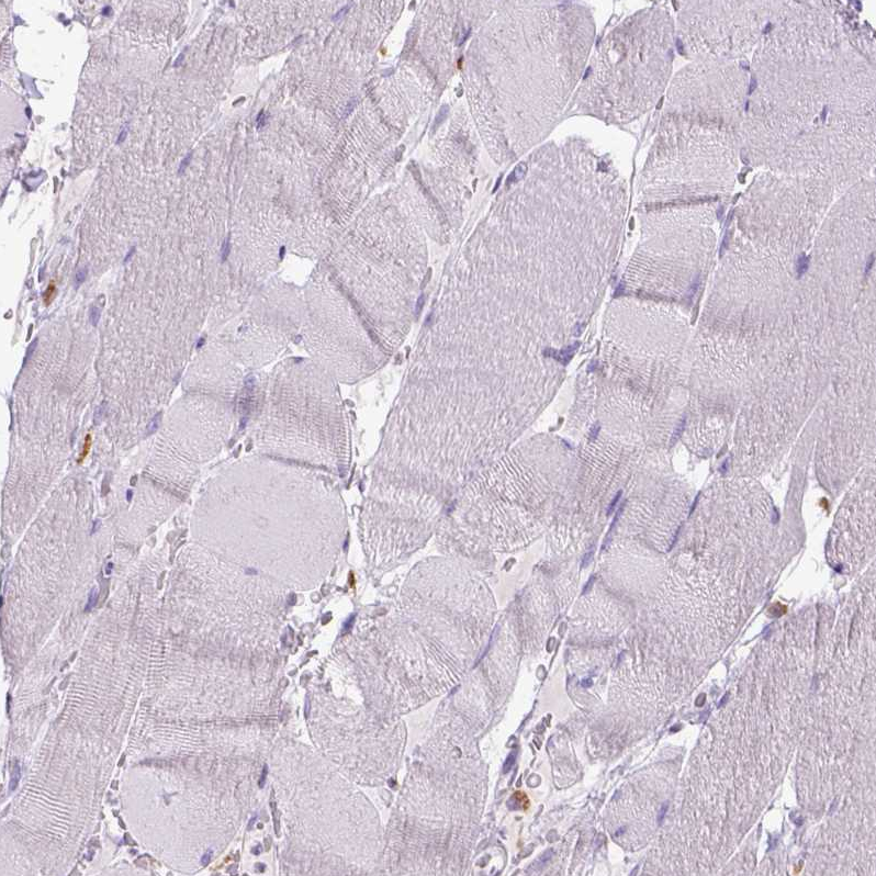 Mouse Monoclonal Anti-CD68 Antibody - Buy for research - Highly ...