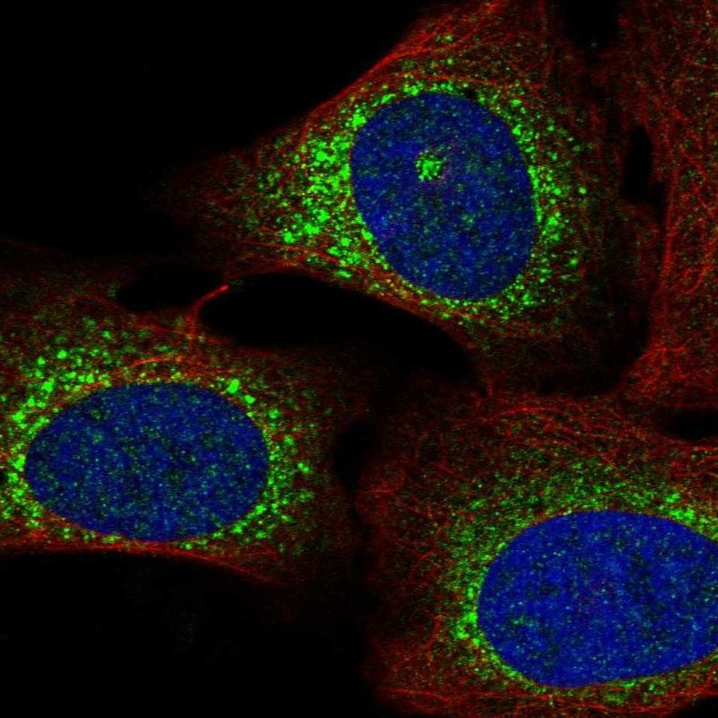 Anti-WISP3 Human Protein Atlas Antibody