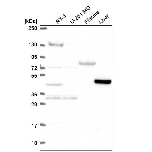Our anti-LDHD antibody cited in a study on soft-tissue sarcoma research
