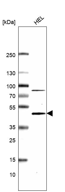 Mouse Monoclonal Anti-CMPK2 Antibody - Buy for research - Highly specific, rigorously validated ...