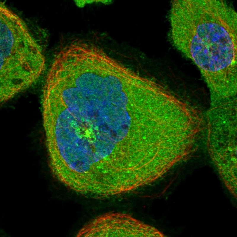 Rabbit Polyclonal Anti-RIOK3 Antibody - Buy for research - Highly ...