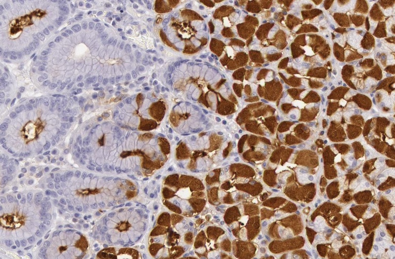 7 Types of Biomarkers