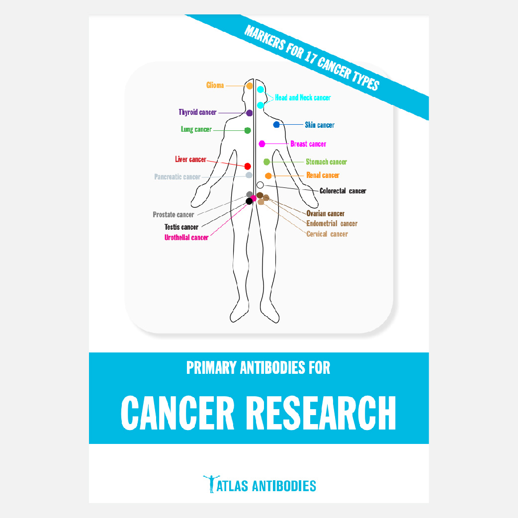 Atlas Antibodies in Cancer Research