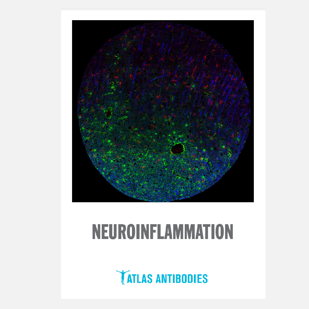 Neuroinflammation