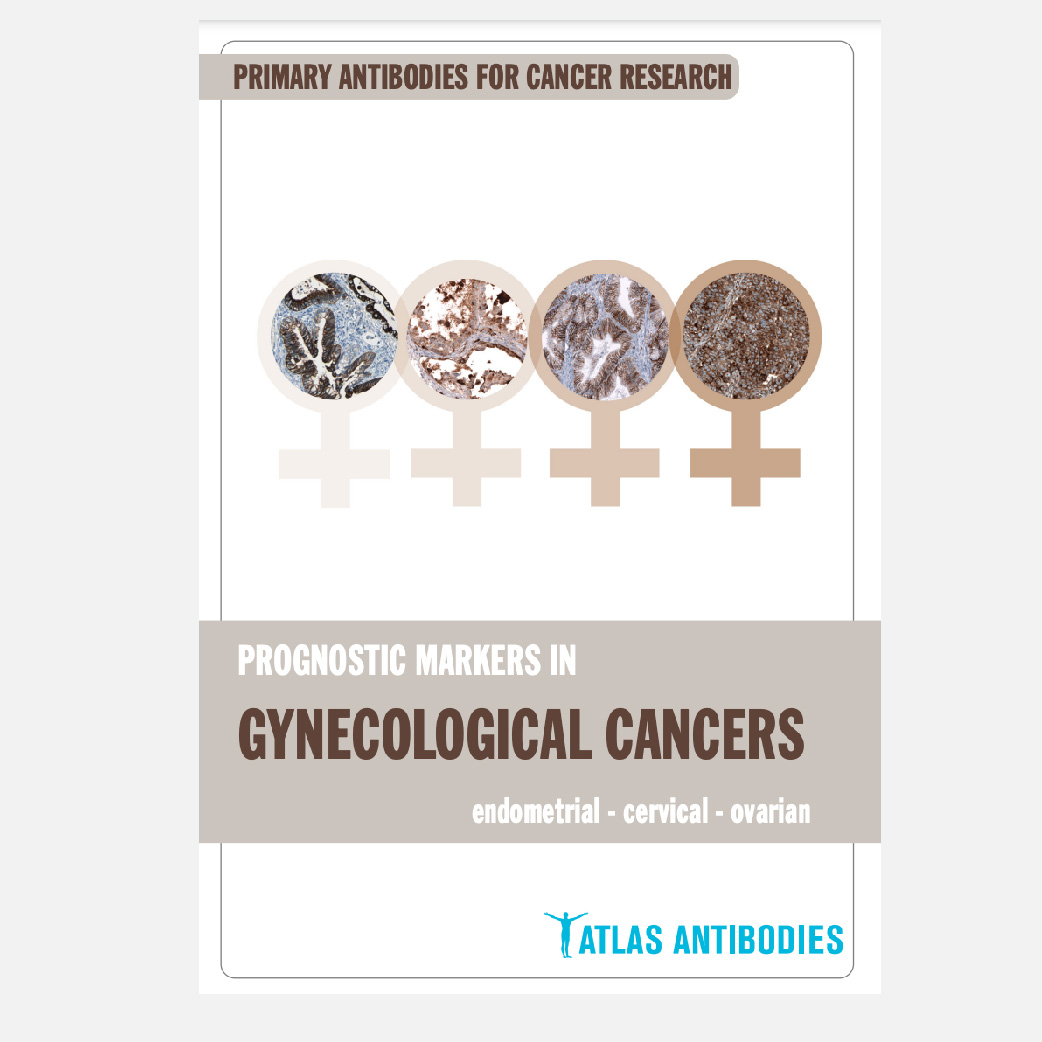 Prognostic Markers in Gynecological Cancers
