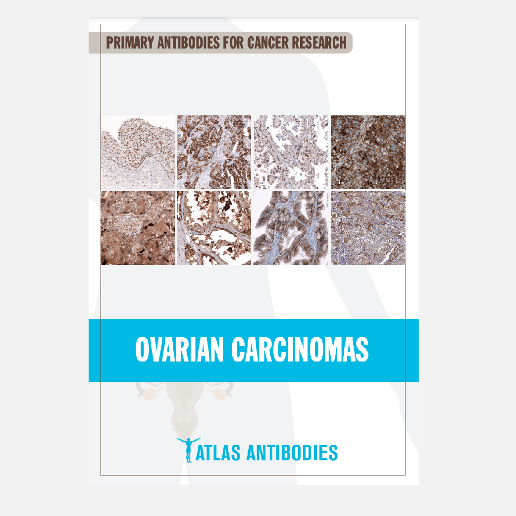 Ovarian Cancers Markers