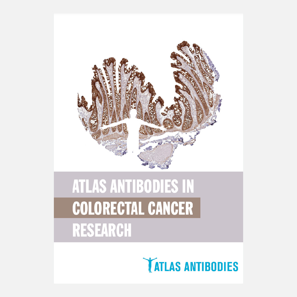 Atlas Antibodies in Colorectal Cancer Research