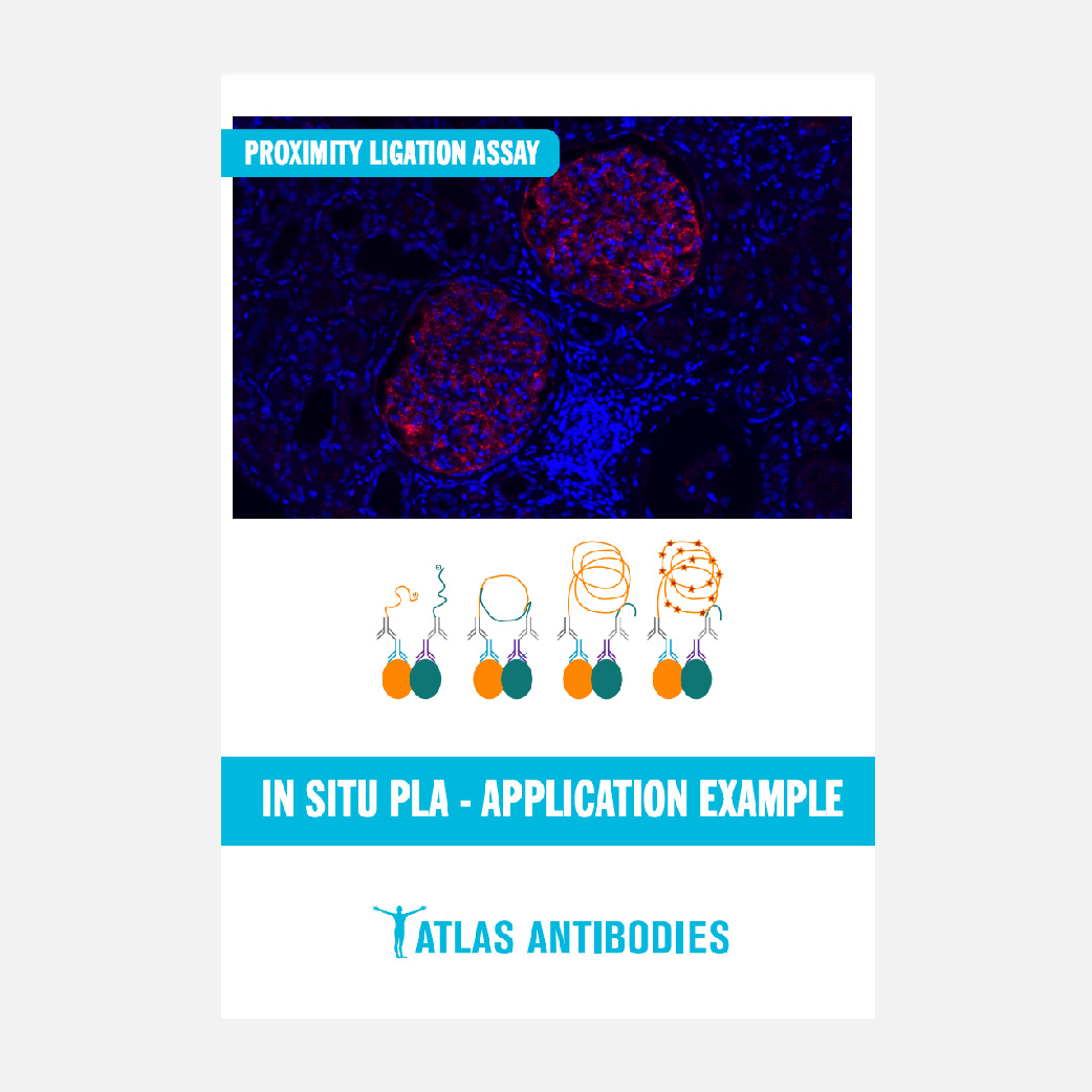 In situ PLA - Application Example