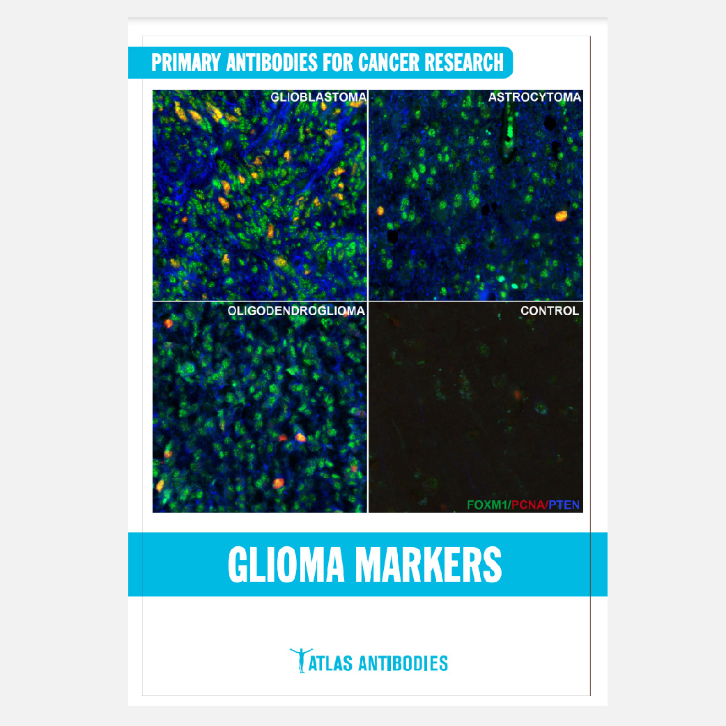 Glioma Markers