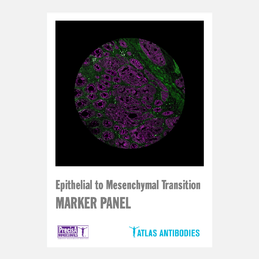 Epithelial-to-Mesenchymal Transition Markers