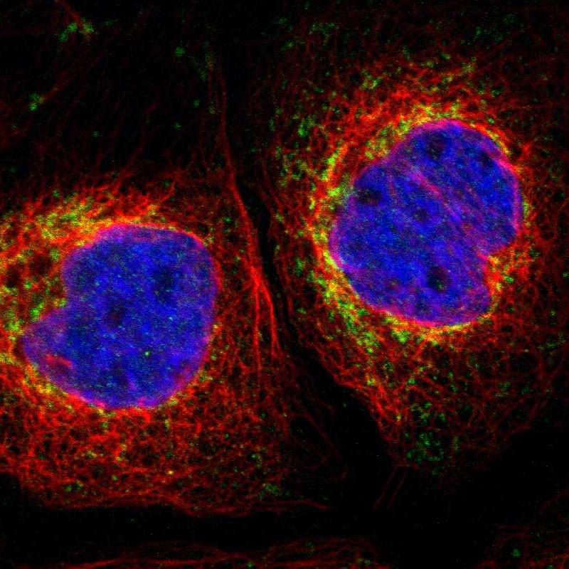 Rabbit Polyclonal Anti-MRPL10 Antibody - Buy for research - Highly ...