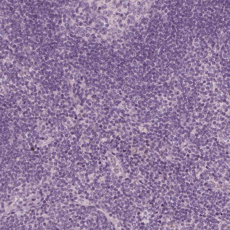 Rabbit Polyclonal Anti-ZP4 Antibody - Buy for research - Highly ...