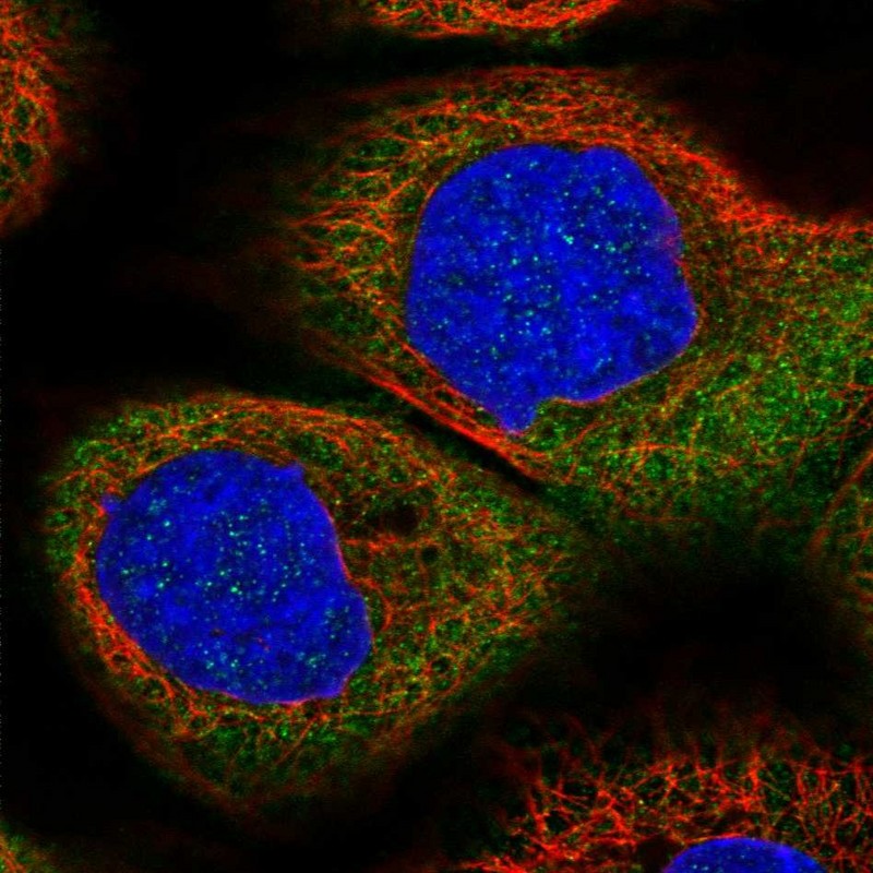 Rabbit Polyclonal Anti-DHX29 Antibody - Buy for research - Highly ...