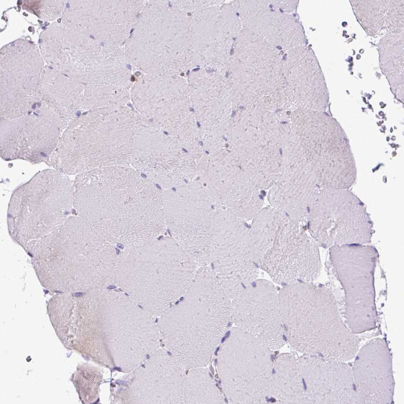 Rabbit Polyclonal Anti-PLS1 Antibody - Buy for research - Highly ...