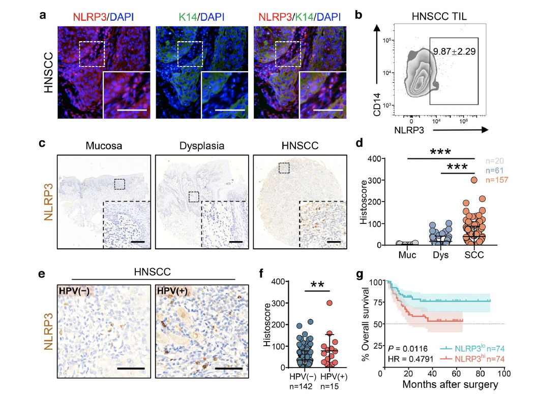 Our anti-NLRP3 antibody in head and neck cancer study