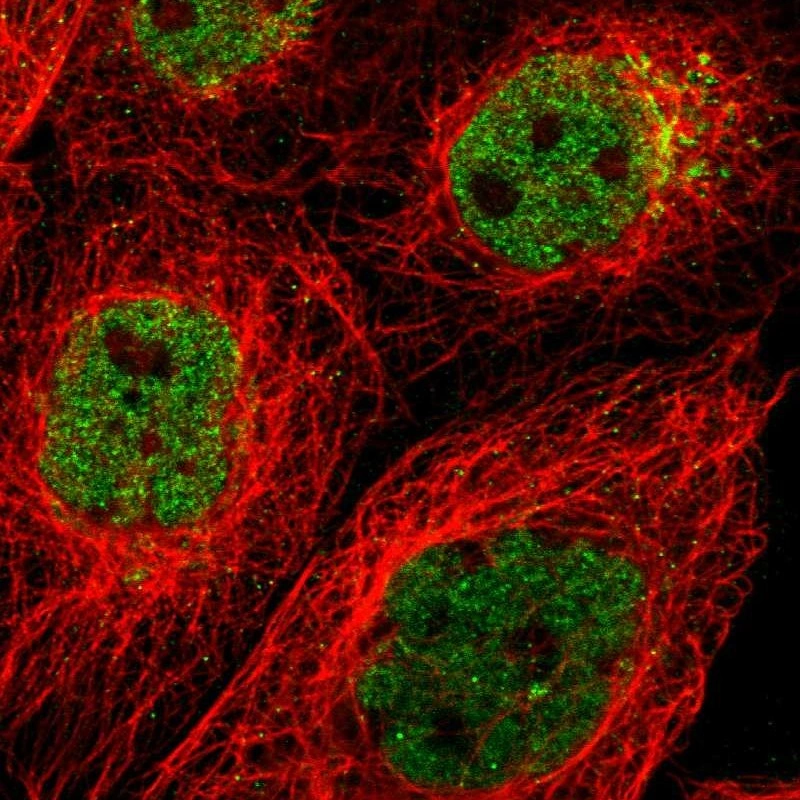 Anti-ZMYND8 Human Protein Atlas Antibody