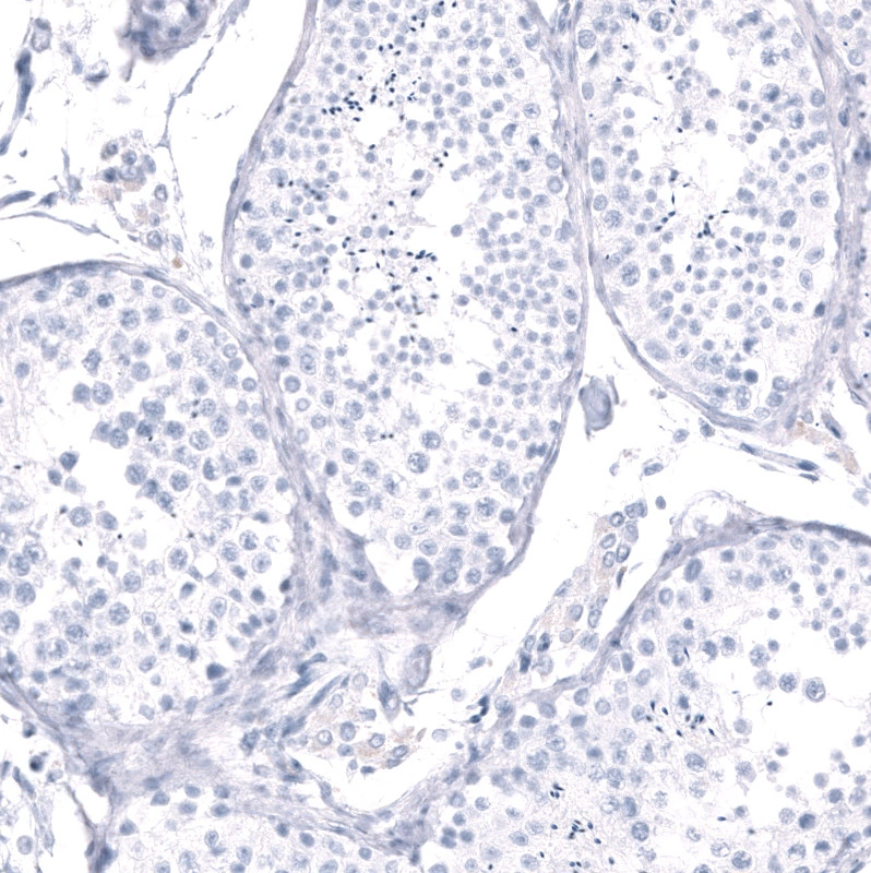 Anti-EYS Human Protein Atlas Antibody