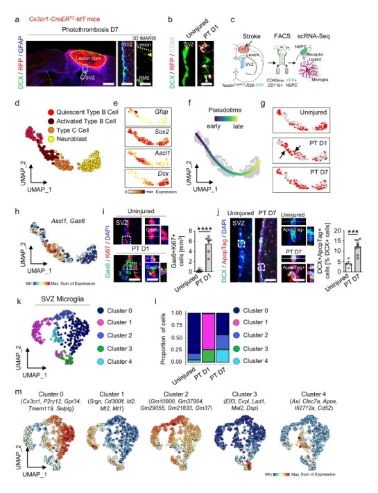 Role of microglia in brain repair after stroke