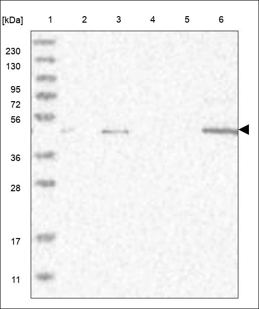 Anti-MUS81 Human Protein Atlas Antibody