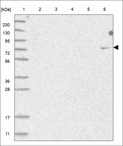 Rabbit Polyclonal Anti-MUSK Antibody - Buy for research - Highly specific, rigorously validated ...