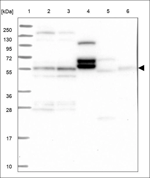 Rabbit Polyclonal Anti-TADA2B Antibody - Buy for research - Highly ...