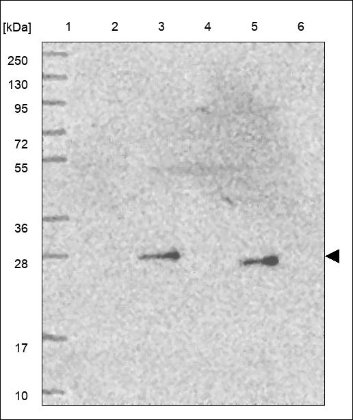 Rabbit Polyclonal Anti-EXOSC5 Antibody - Buy for research - Highly specific, rigorously ...